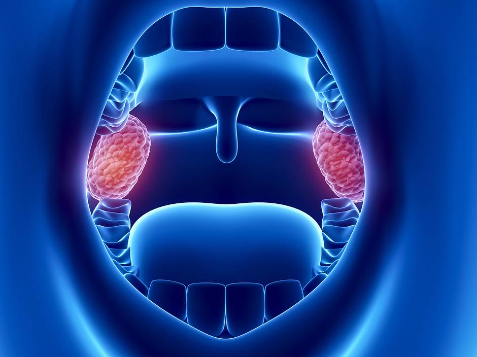 Mandeln - Türsteher des Körpers | Wunderweib