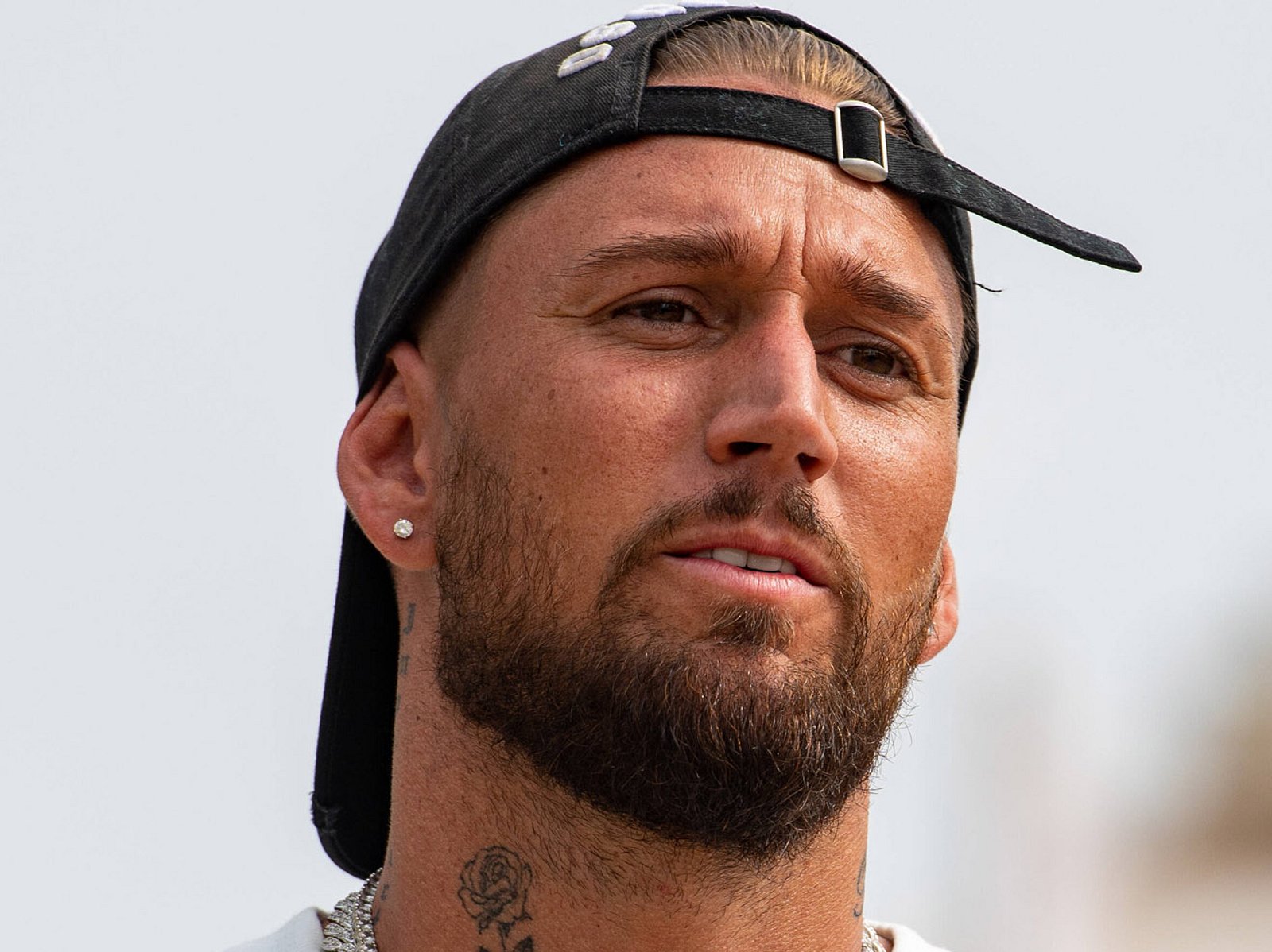 Mike Heiter: Das ist mit seinem Gesicht passiert! | Wunderweib