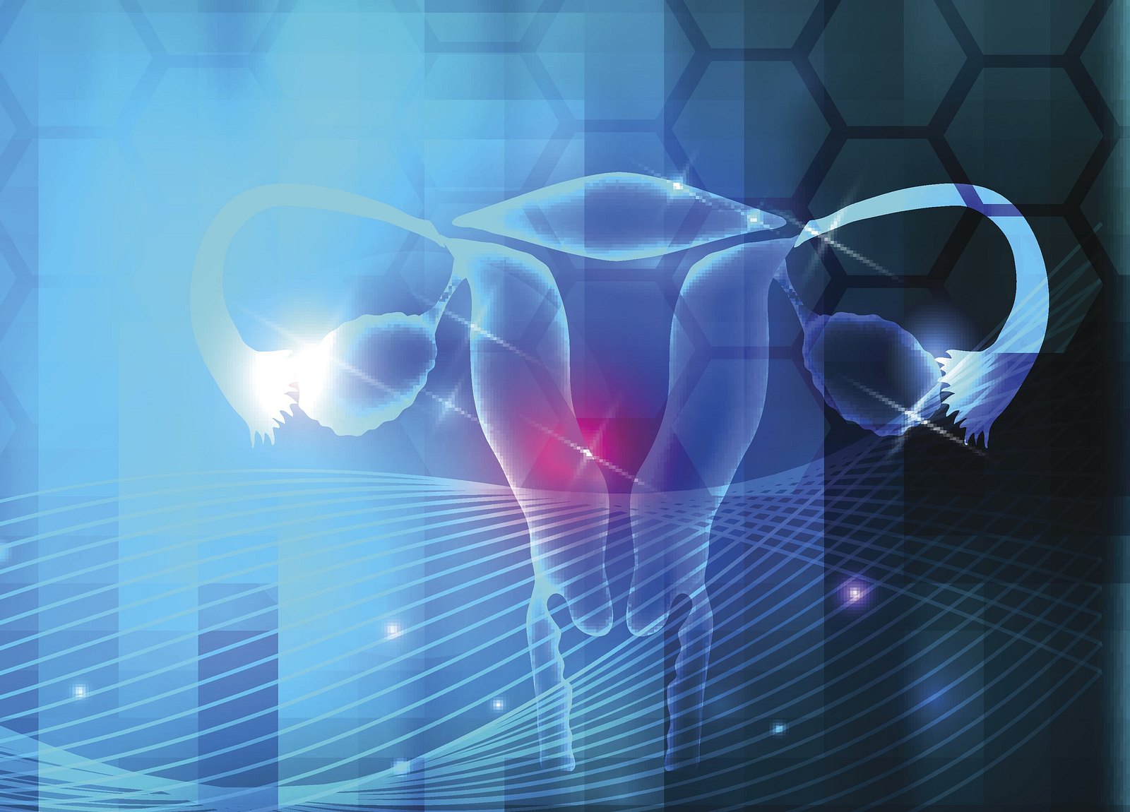 PCO-Syndrom: Was du über das Polyzystische Ovarialsyndrom wissen ...