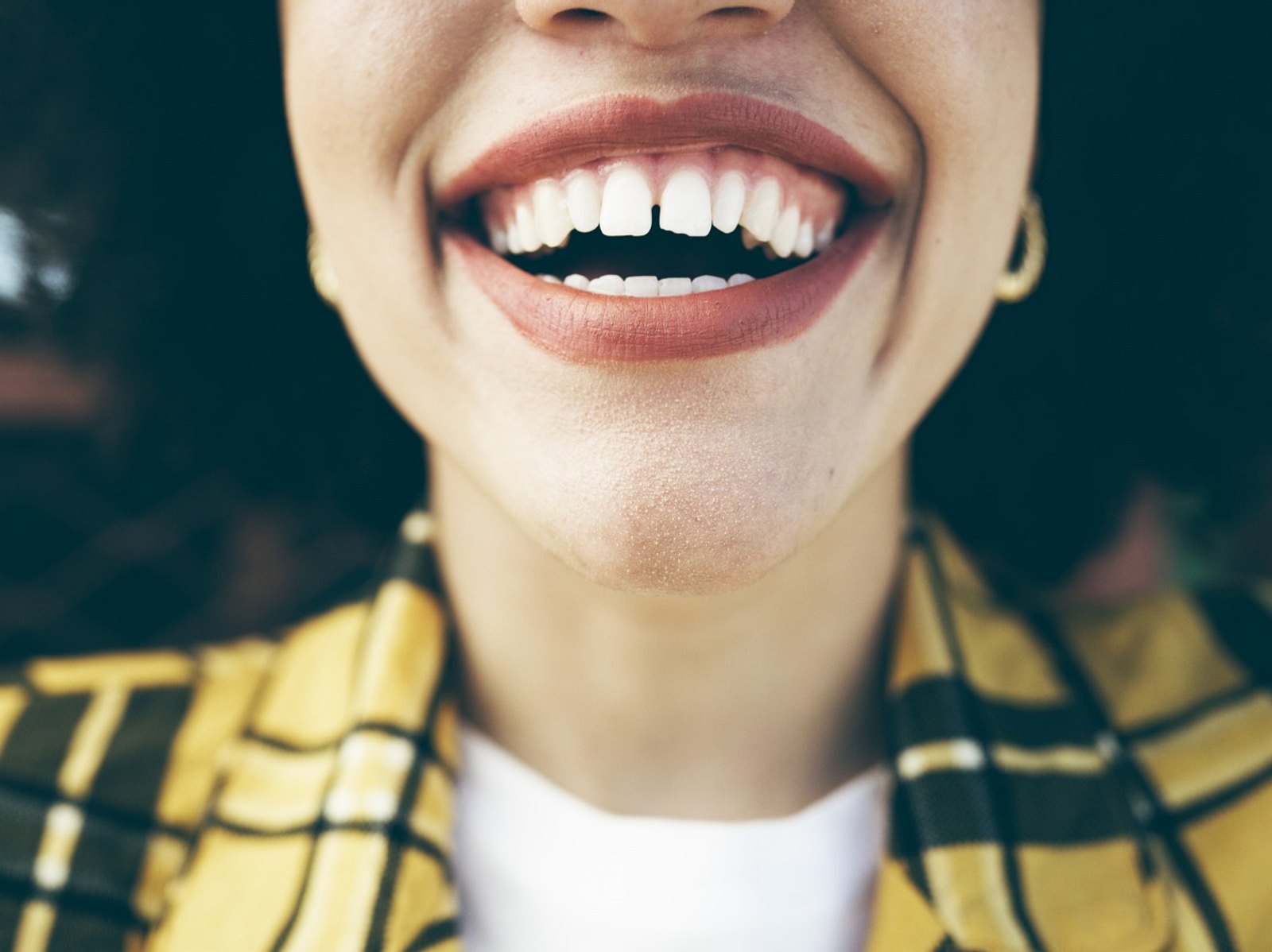 Zahnstein selbst entfernen: So geht's! | Wunderweib